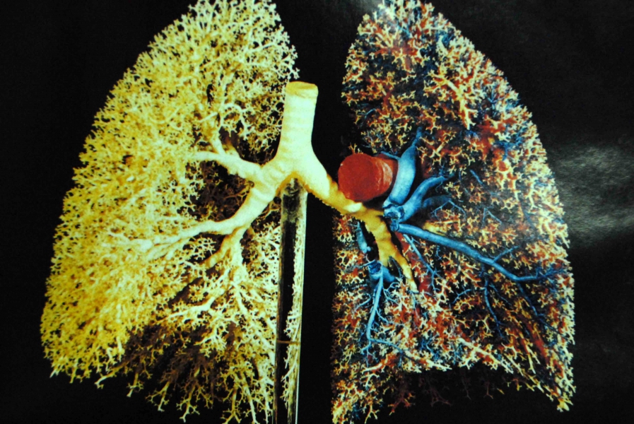 Despre cancerul pulmonar | Răsunetul